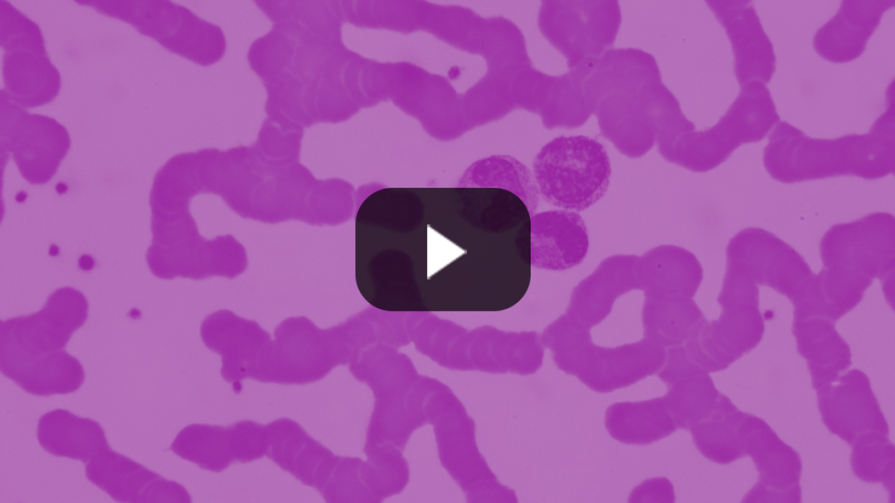 How Evolution Explains Antibiotic-Resistant Superbugs | Columbia ...