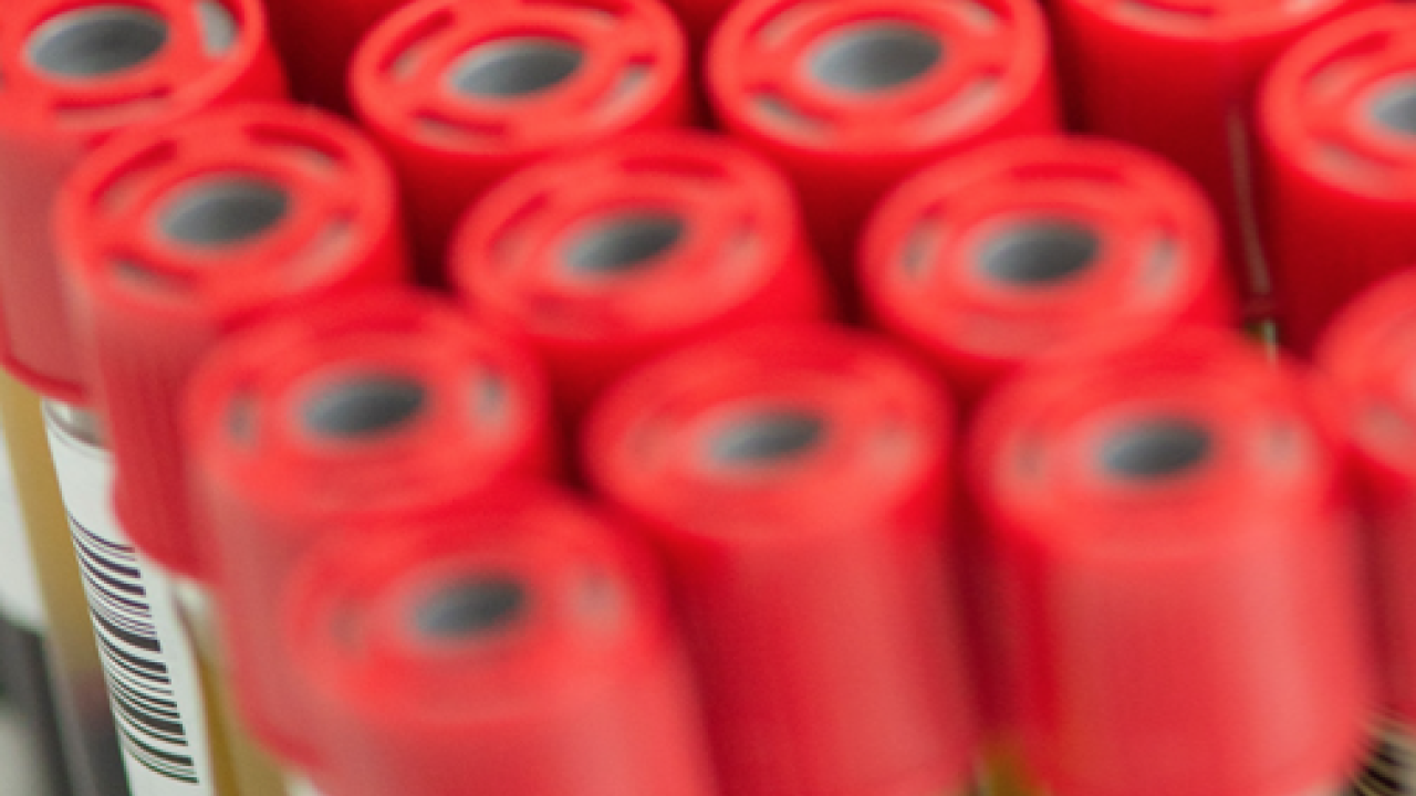 Clinical Trial Suggests Convalescent Plasma May Improve Survival with ...