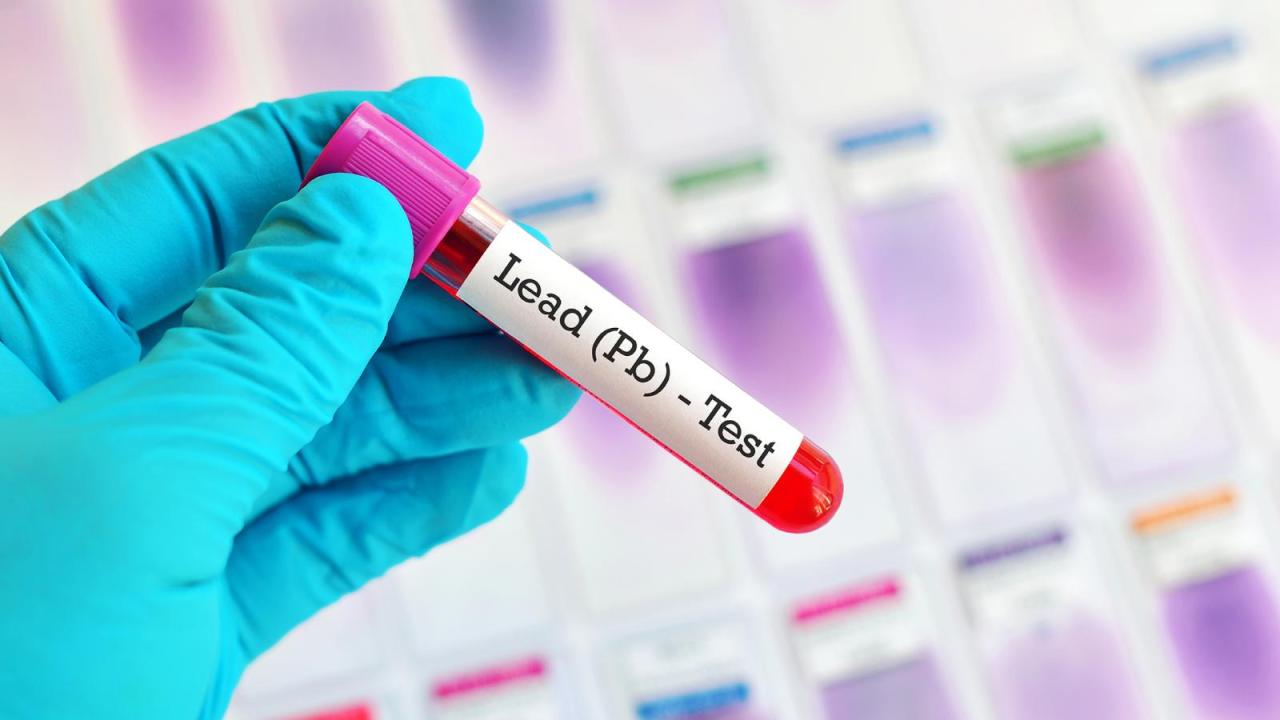 Low-Level Lead Poisoning Is Still Pervasive in the U.S. and Globally ...