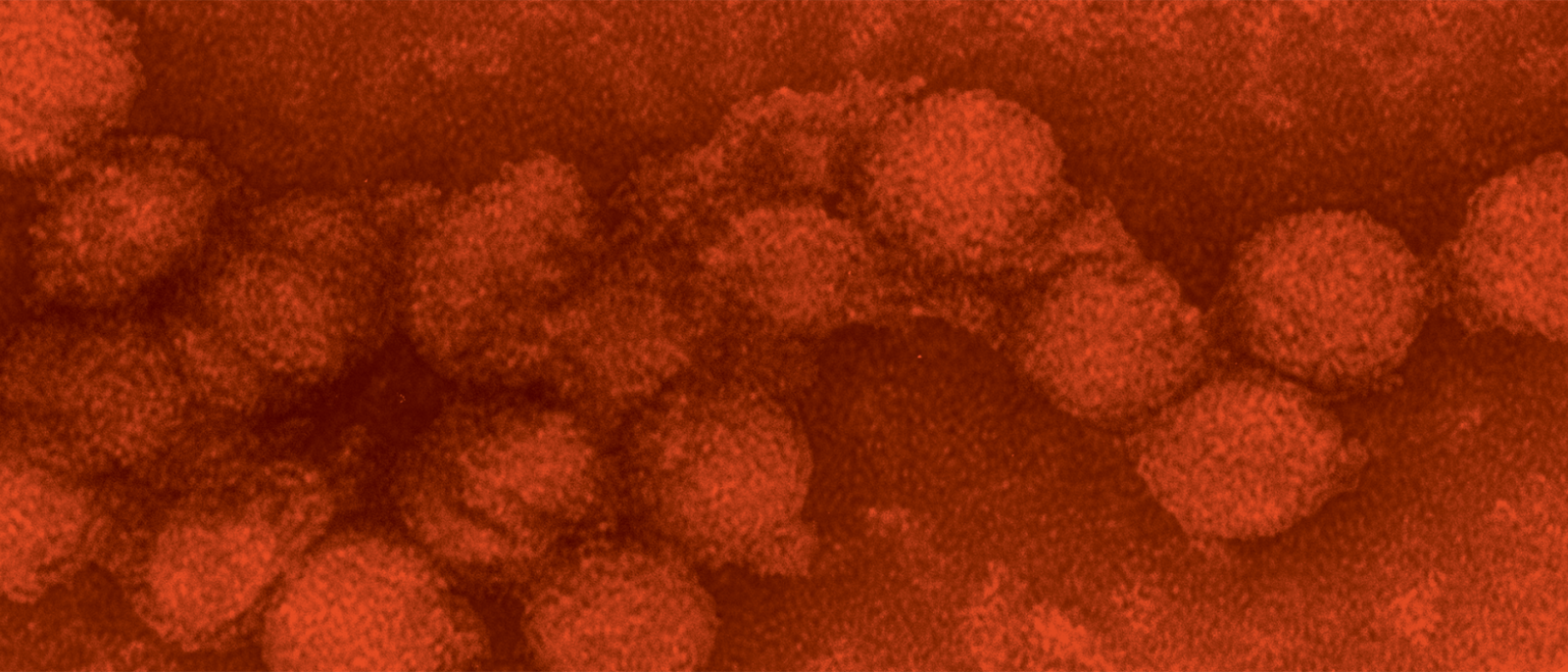 Leading the Global Fight Against Infectious Diseases | Columbia ...