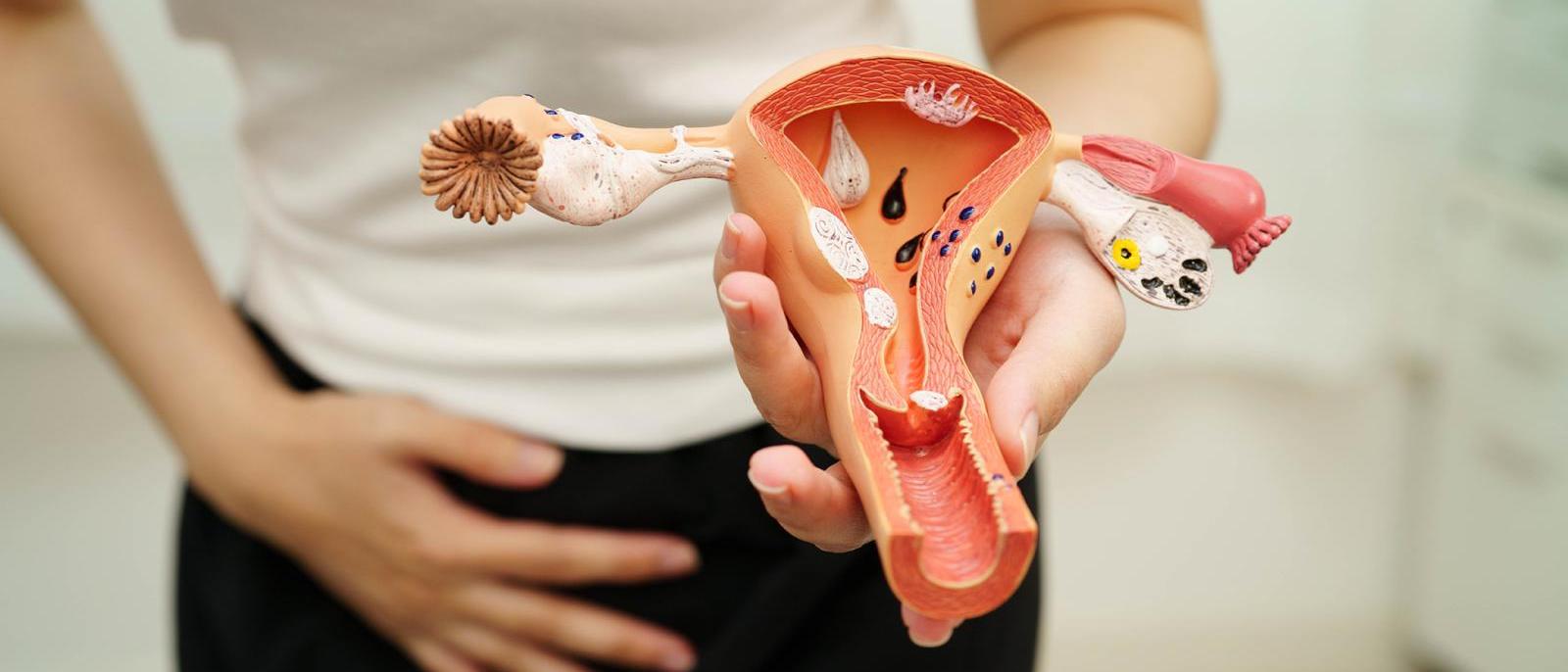 Menstrual Health Education and Programs Must Reach All Young ...