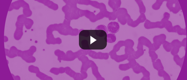 How Evolution Explains Antibiotic-Resistant Superbugs | Columbia ...